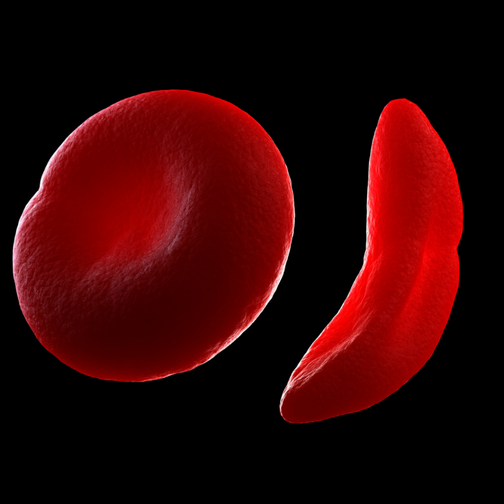 Raising Awareness: Empowering Lives On Sickle Cell Awareness Day ...